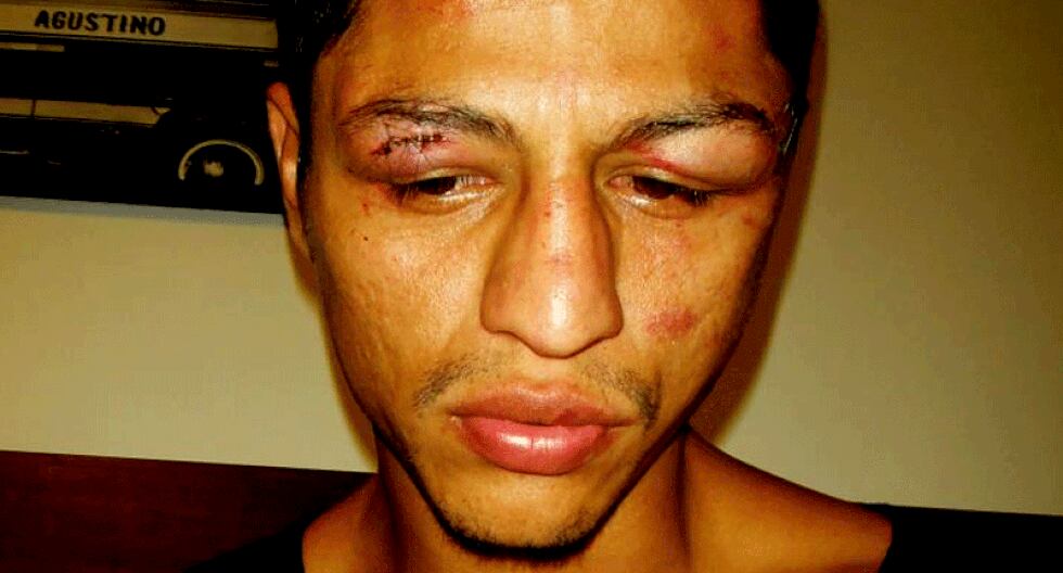 Así quedó: Maicelo muestra en Facebook su rostro tras el título ...